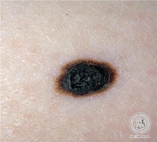 VIDA Y SALUD: Cabeza y cuello